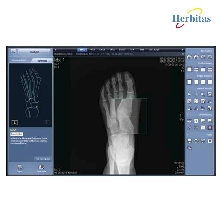 Flat Panel | Sistema de Radiografia Digital | Herbitas®